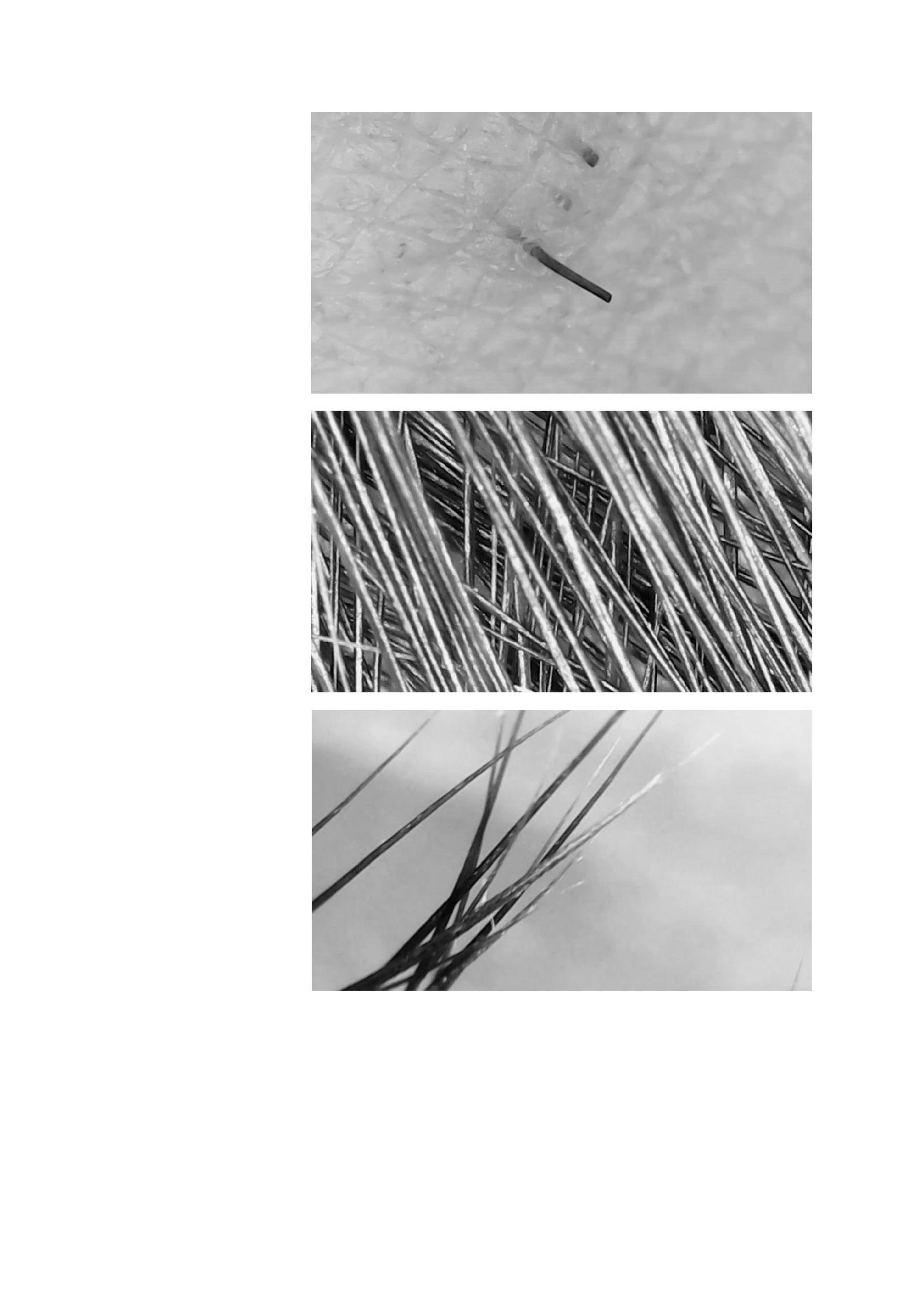 Body == Device, 2016- – Emily Roderick